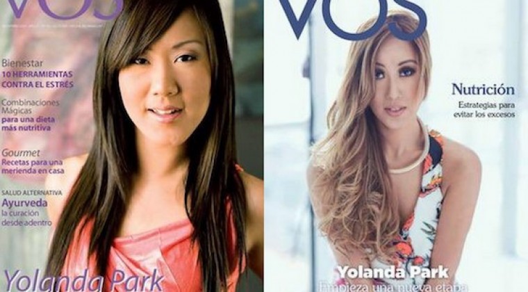 Diario HOY | Critican el antes y después de Yolanda y ella sale al paso